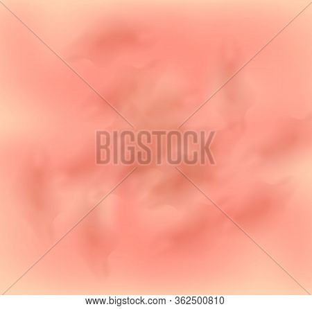 Skin Inflammation. Image & Photo (Free Trial) | Bigstock
