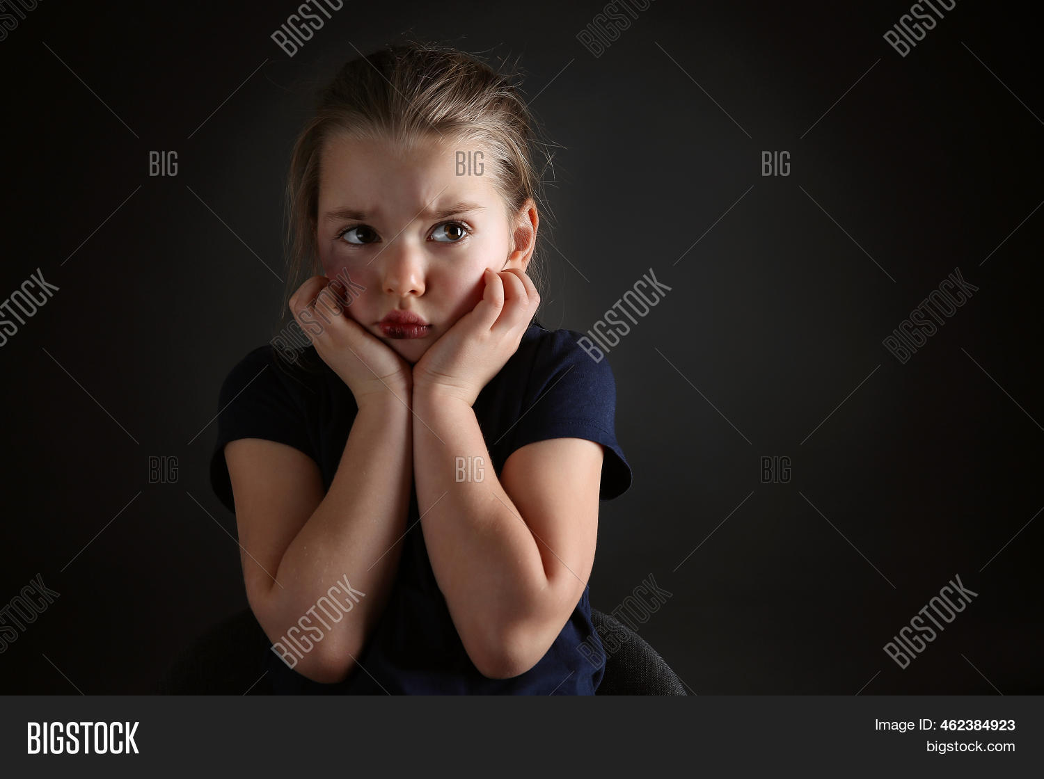 Little Girl Bruises On Image & Photo (Free Trial) | Bigstock