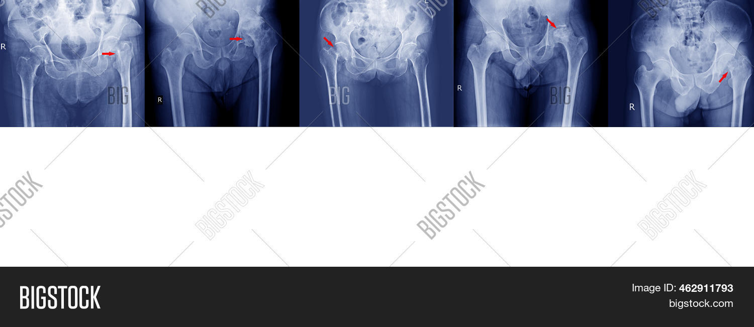 Imagen y foto Collection X-ray (prueba gratis) | Bigstock