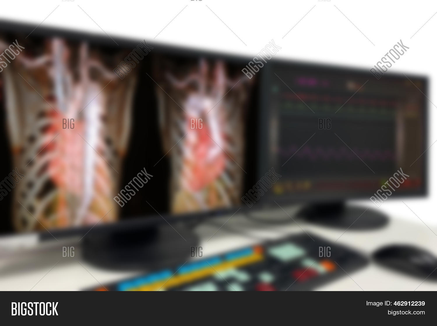 Gaussian Blur Ct Scan Image & Photo (Free Trial) | Bigstock