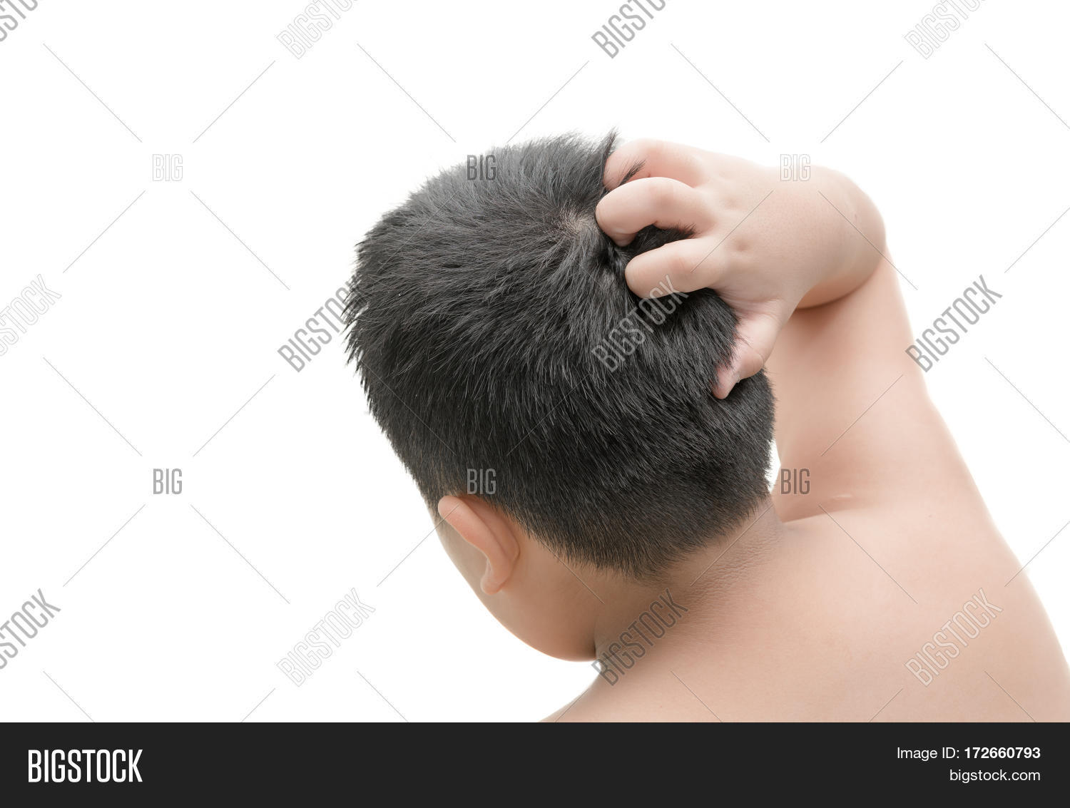 Closeup Boy Hand Itchy Image & Photo (Free Trial) | Bigstock
