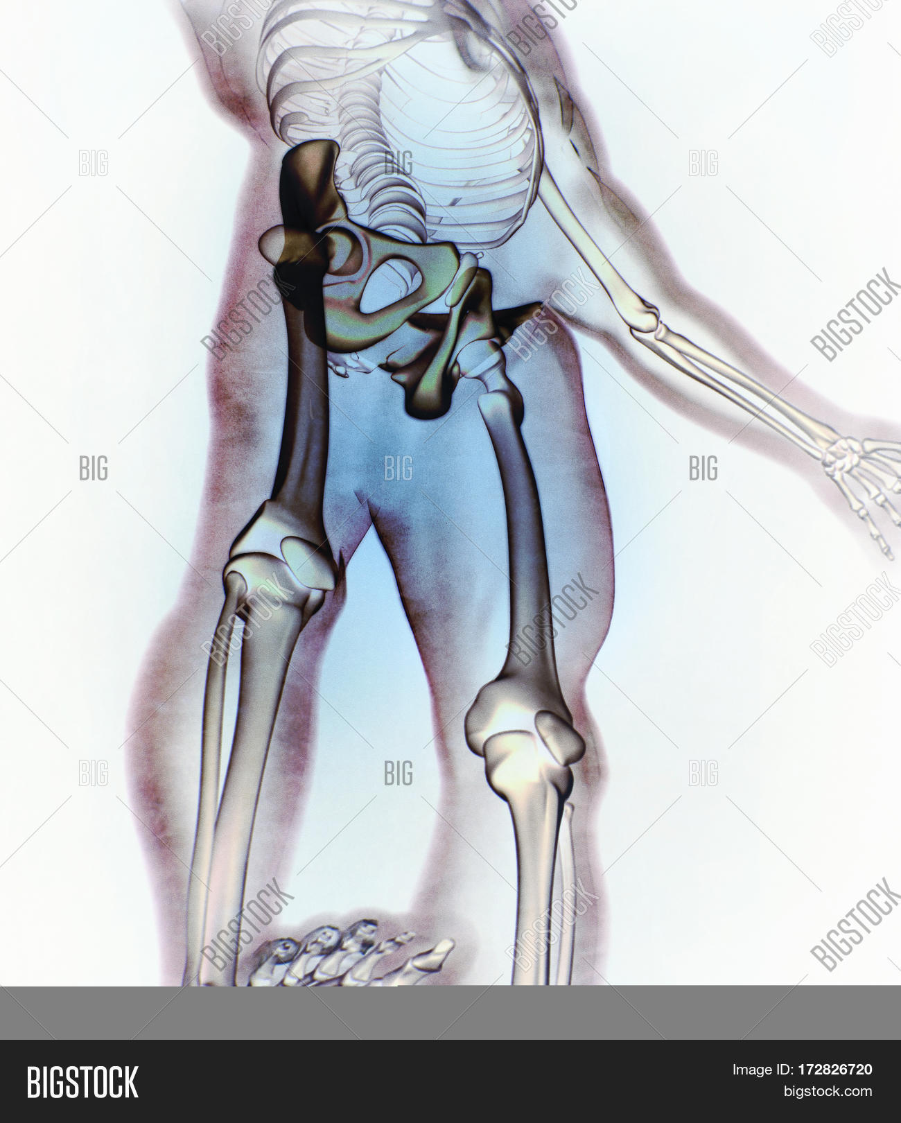 Ilium Bone, Hip Bone Image & Photo (Free Trial) | Bigstock