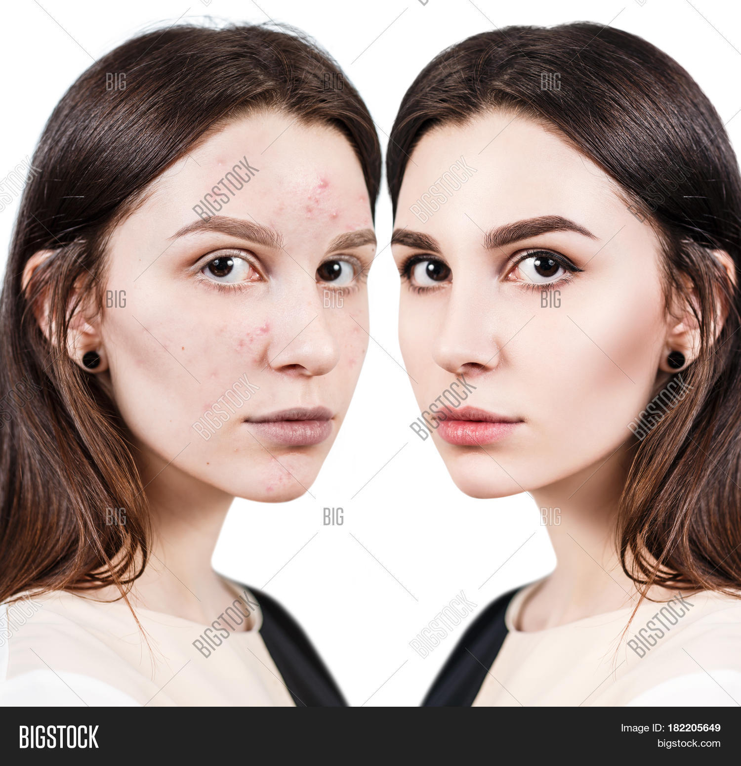 Comparison Portrait Image & Photo (Free Trial) | Bigstock