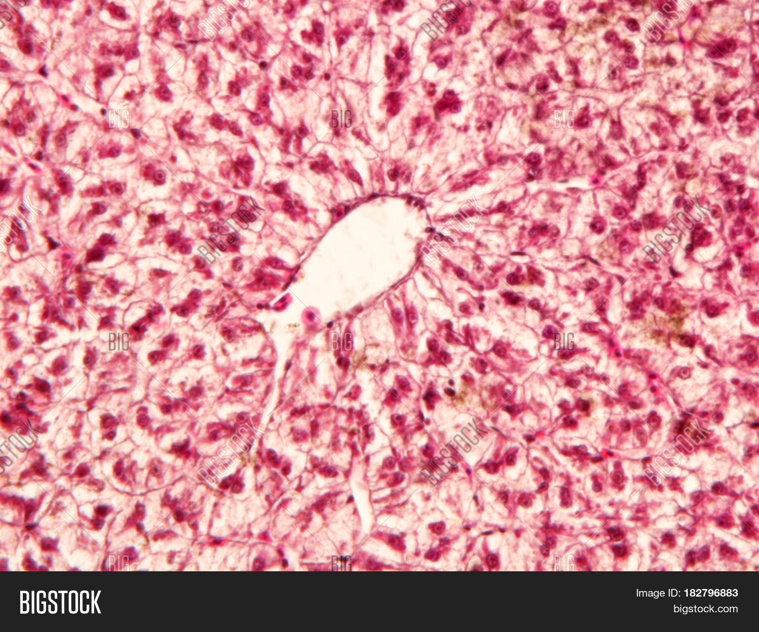 Liver Animal Tissue Image & Photo (Free Trial) | Bigstock