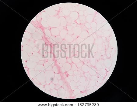 Human Fat Body Tissue Image & Photo (Free Trial) | Bigstock