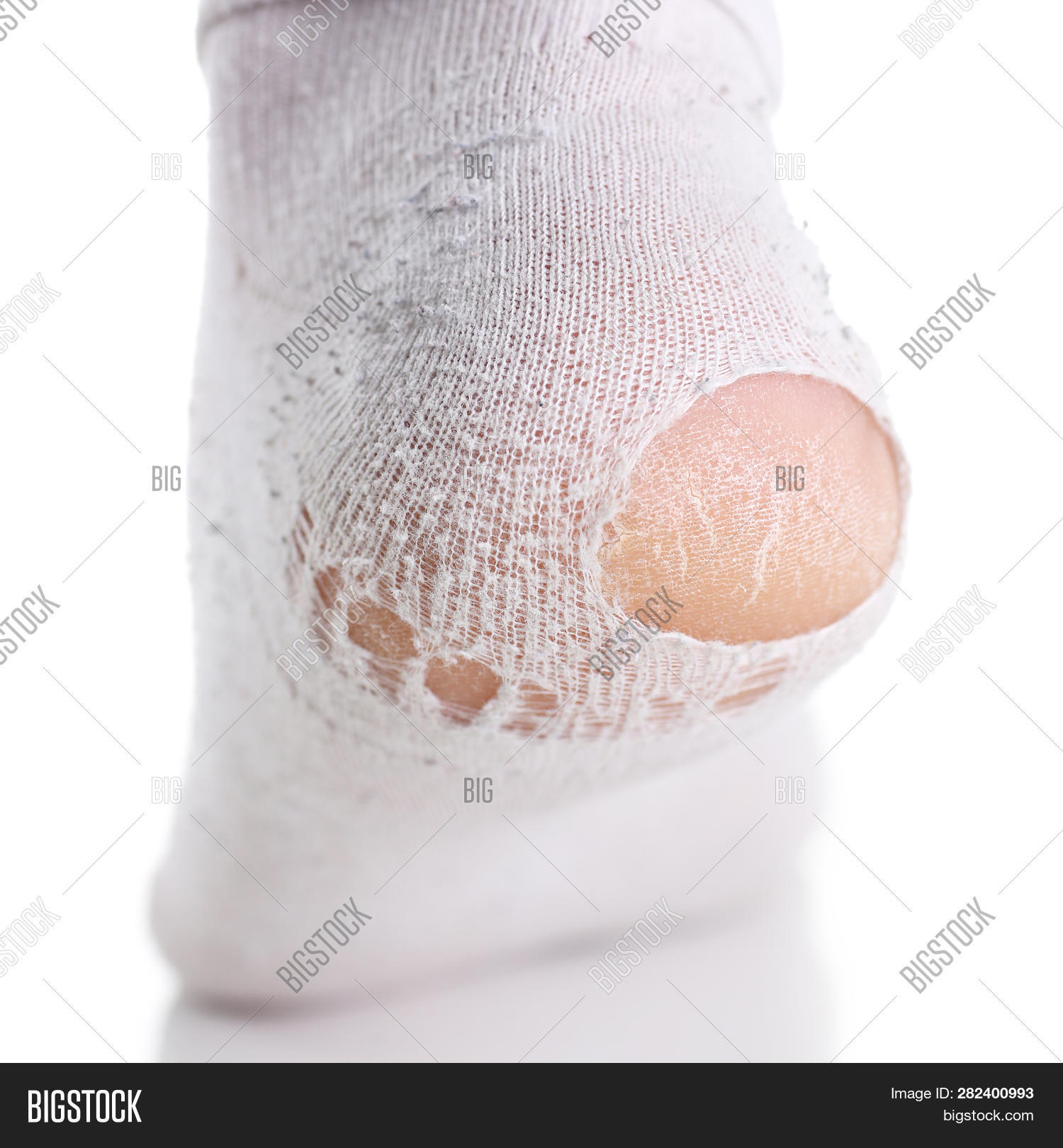 Ripped White Sock On Image & Photo (Free Trial) | Bigstock