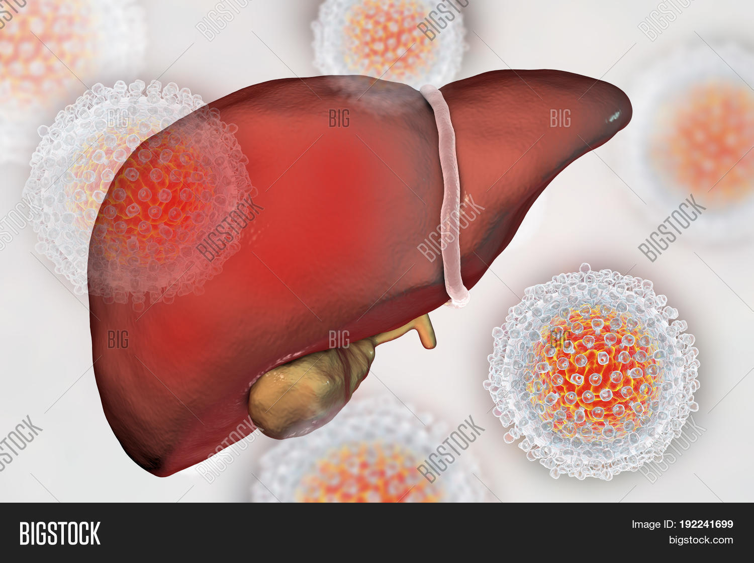 Liver Hepatitis C Image & Photo (Free Trial) | Bigstock