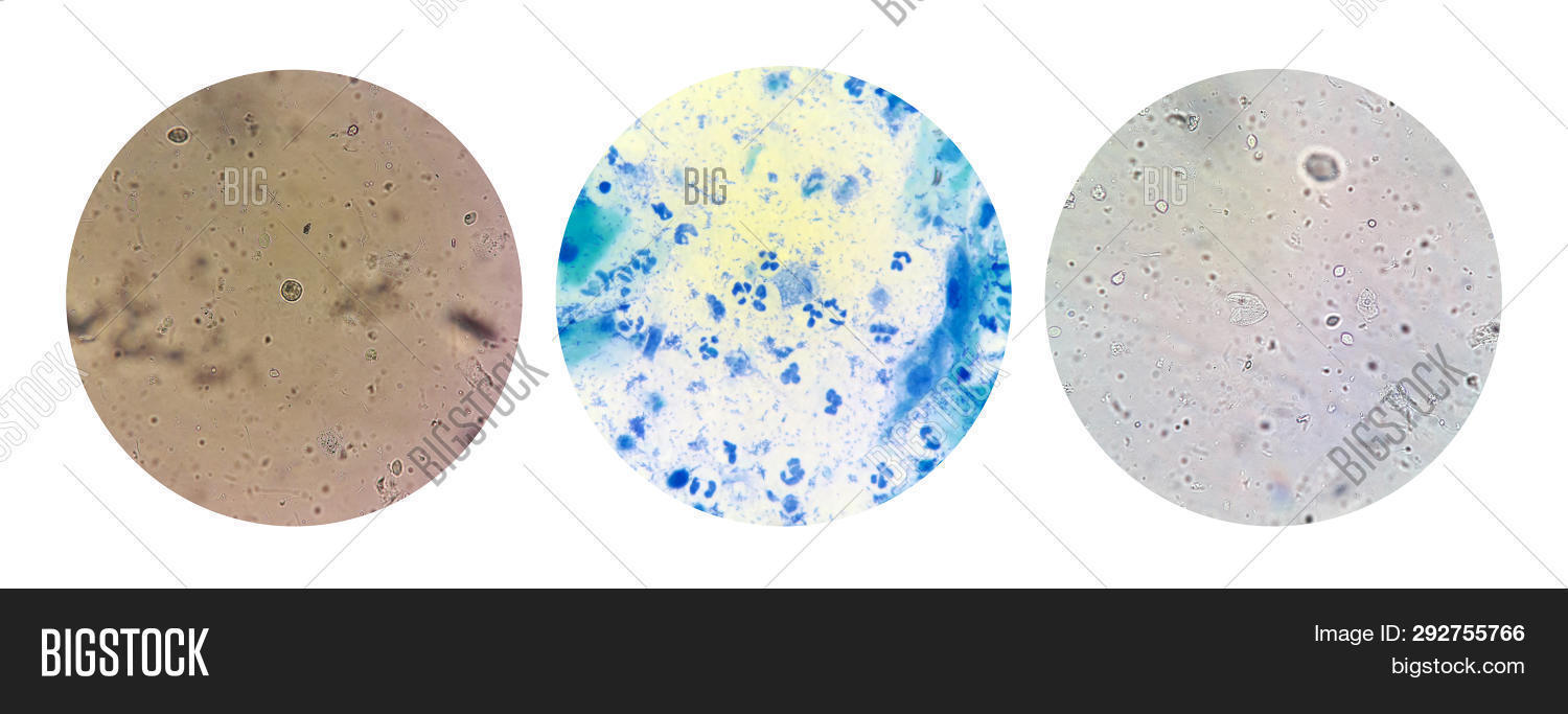 Sexually Transmitted Image & Photo (Free Trial) | Bigstock