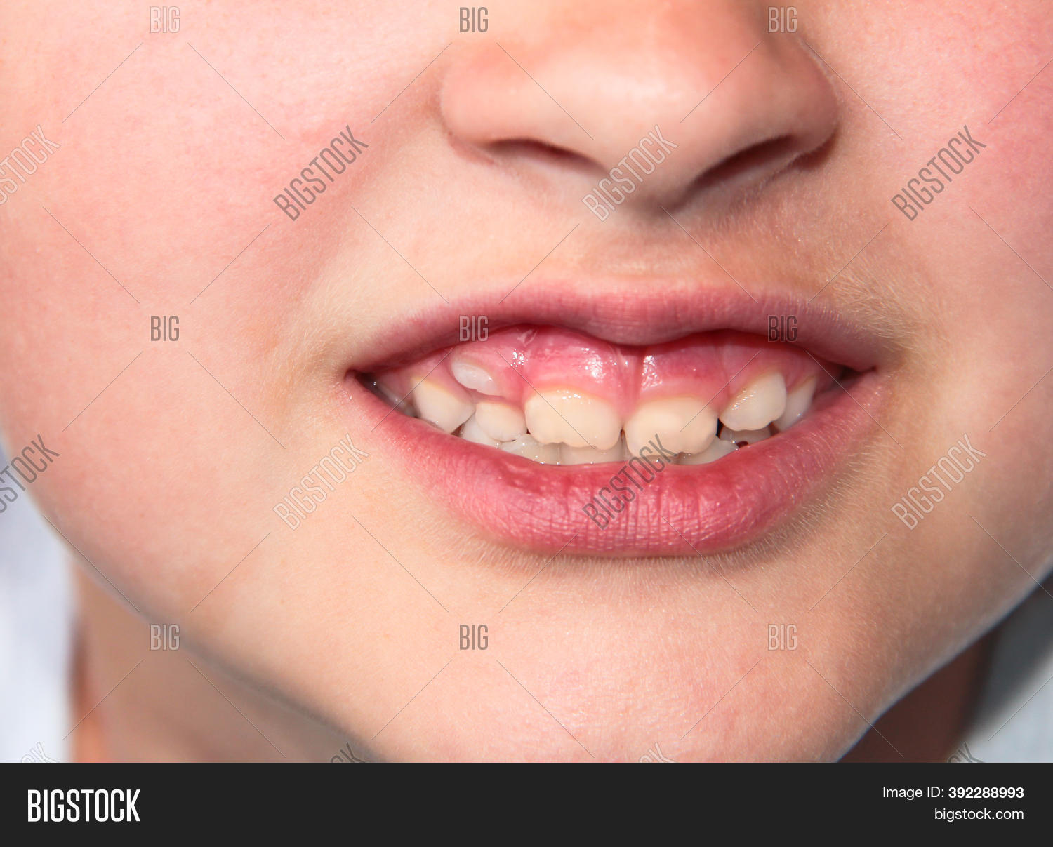 Children's Teeth. Image & Photo (Free Trial) | Bigstock