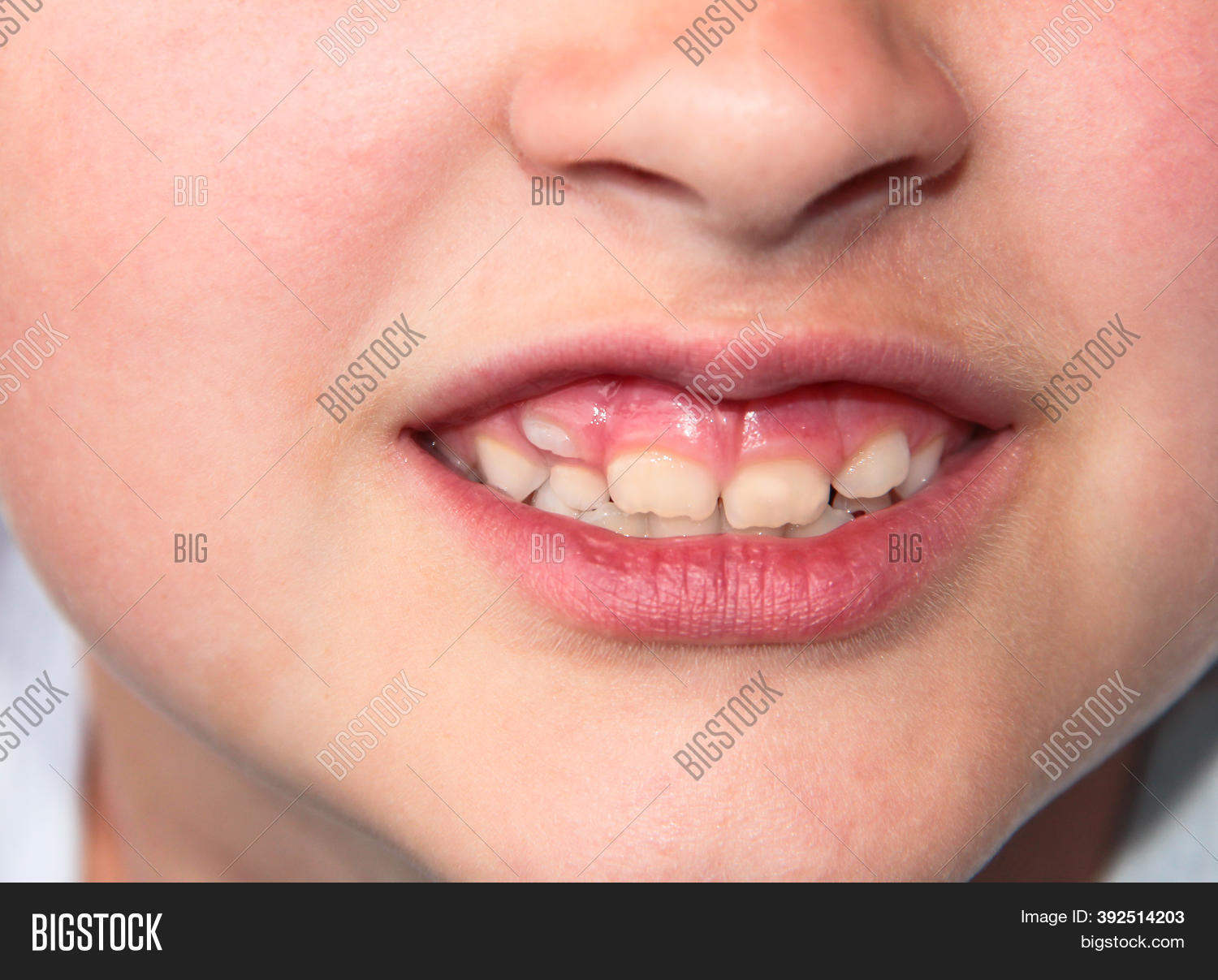 Children's Teeth. Image & Photo (Free Trial) | Bigstock
