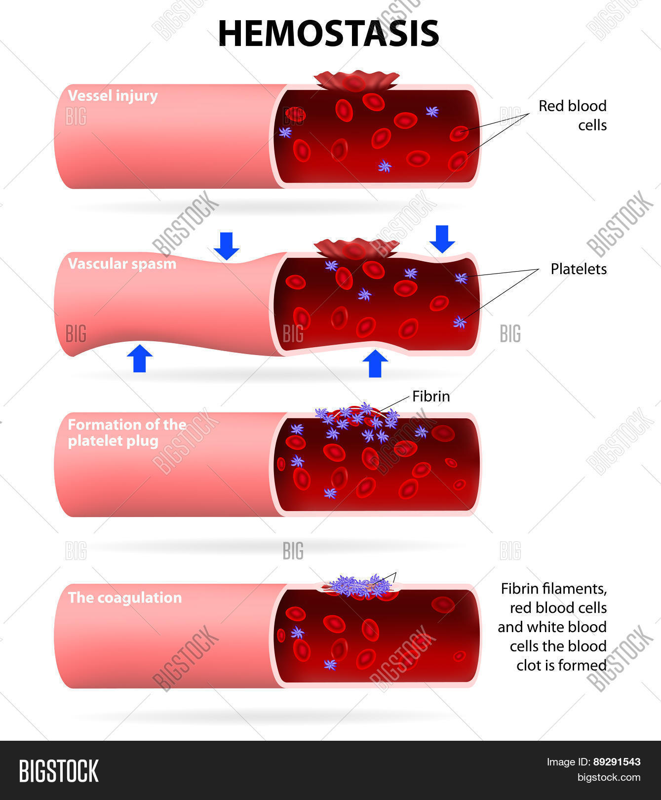 Basic Steps Vector & Photo (Free Trial) | Bigstock
