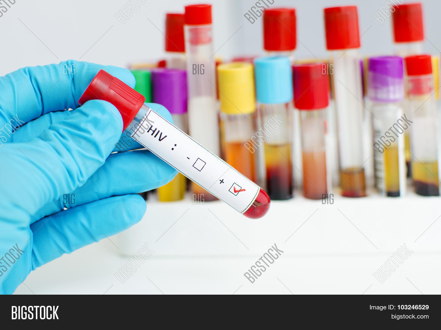 HIV Positive Image & Photo (Free Trial) | Bigstock