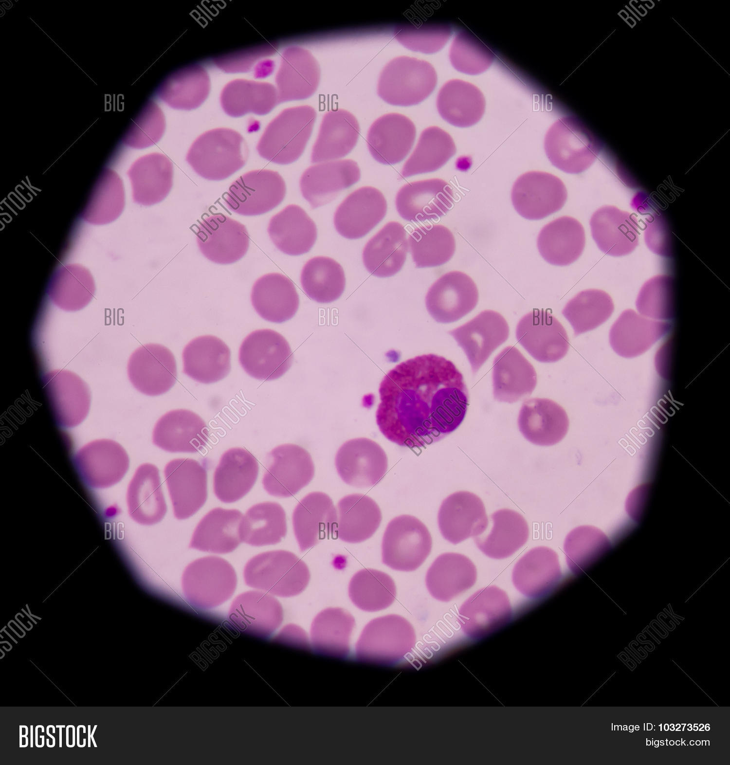 Eosinophil Image & Photo (Free Trial) | Bigstock