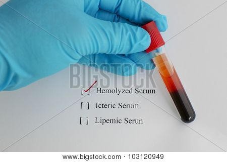 Hemolysis Blood Sample Image & Photo (Free Trial) | Bigstock