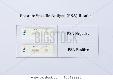 PSA Result Negative Image & Photo (Free Trial) | Bigstock