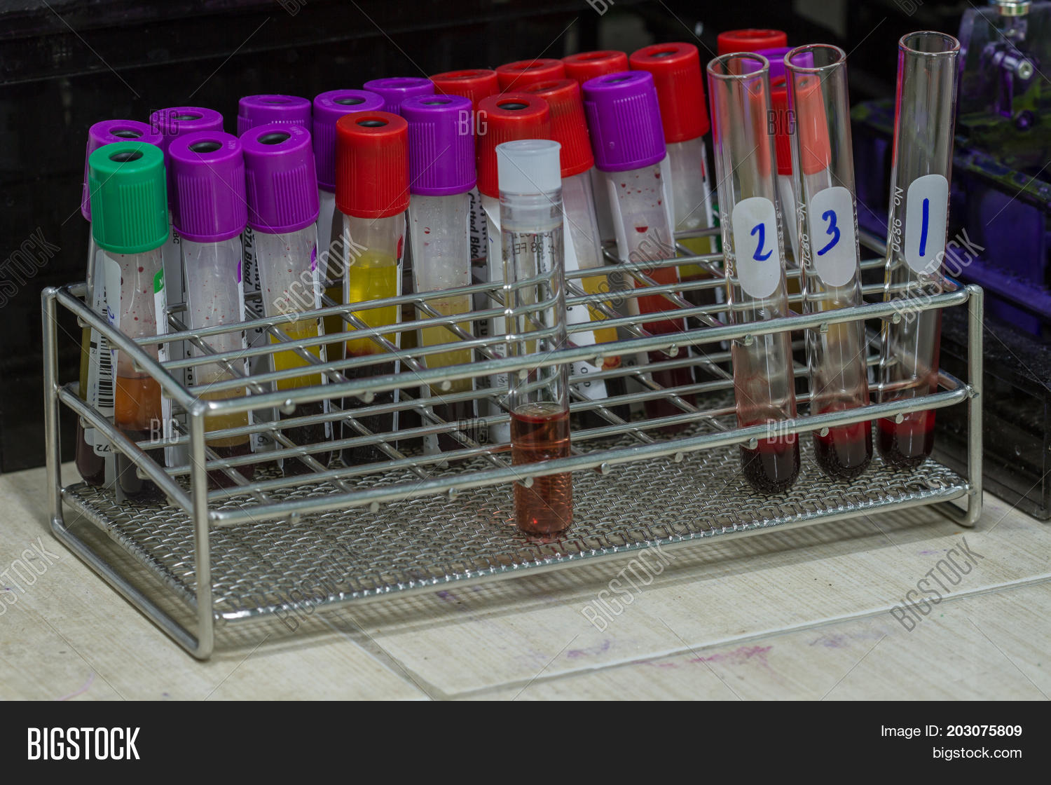 Sputum Genexpert Test Image & Photo (Free Trial) | Bigstock