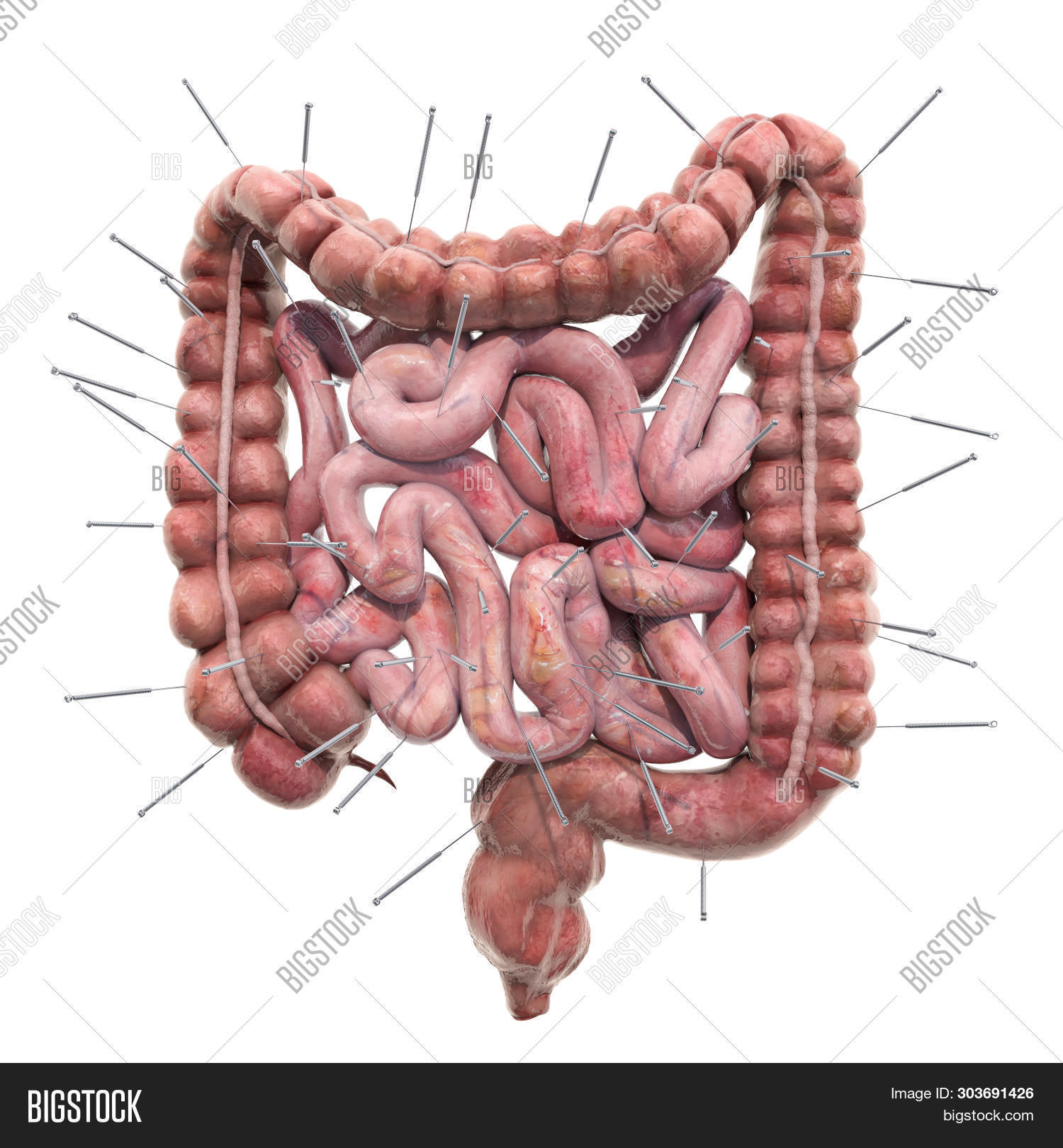 Human Bowel Image & Photo (Free Trial) | Bigstock