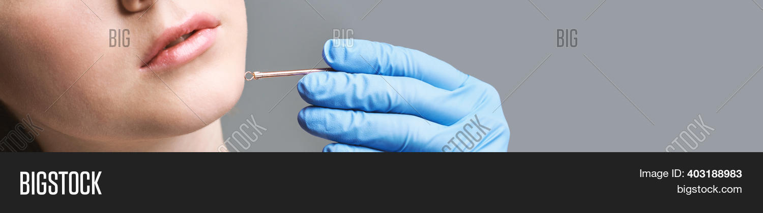 Loop Device Medical Image & Photo (Free Trial) | Bigstock