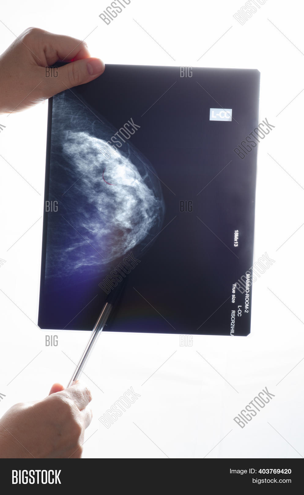 Mammogram X-ray Left Image & Photo (Free Trial) | Bigstock