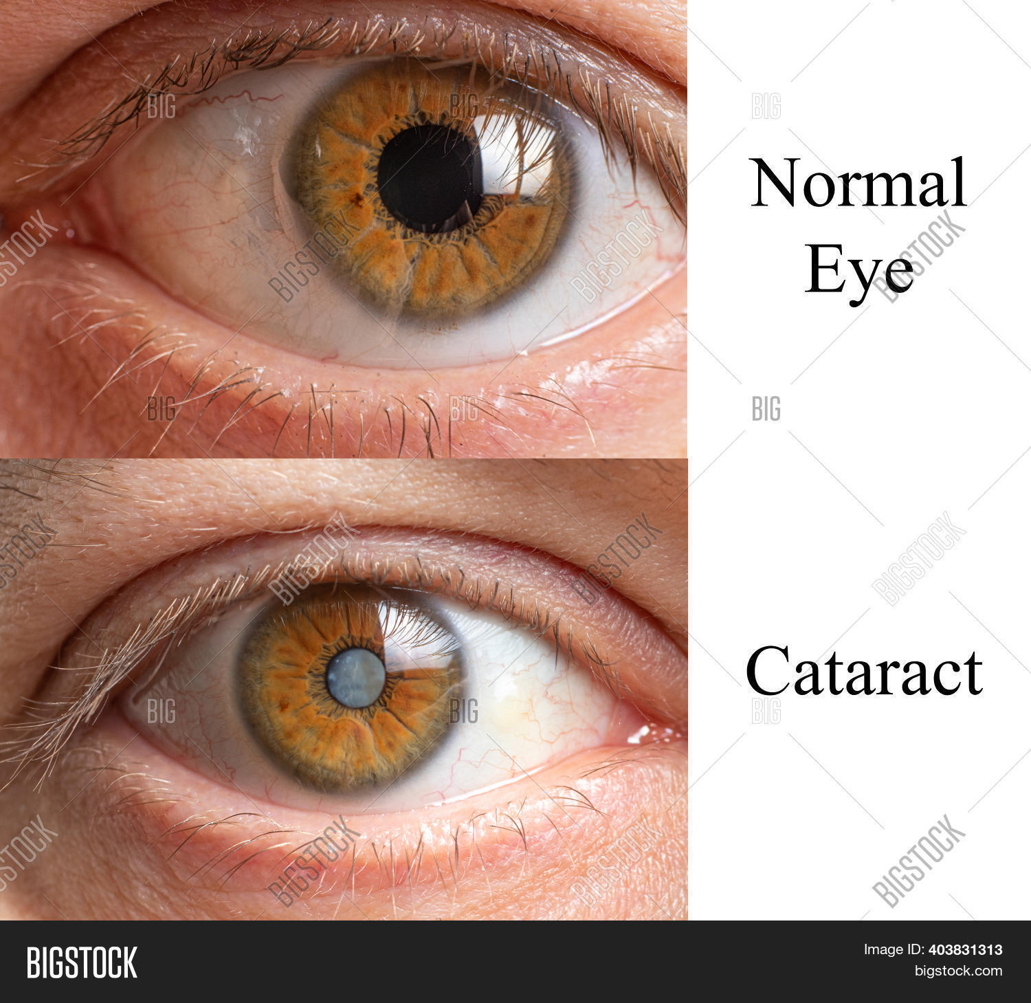 Comparison Healthy Image & Photo (Free Trial) | Bigstock