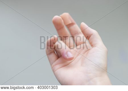 Abscess On Finger. Image & Photo (Free Trial) | Bigstock