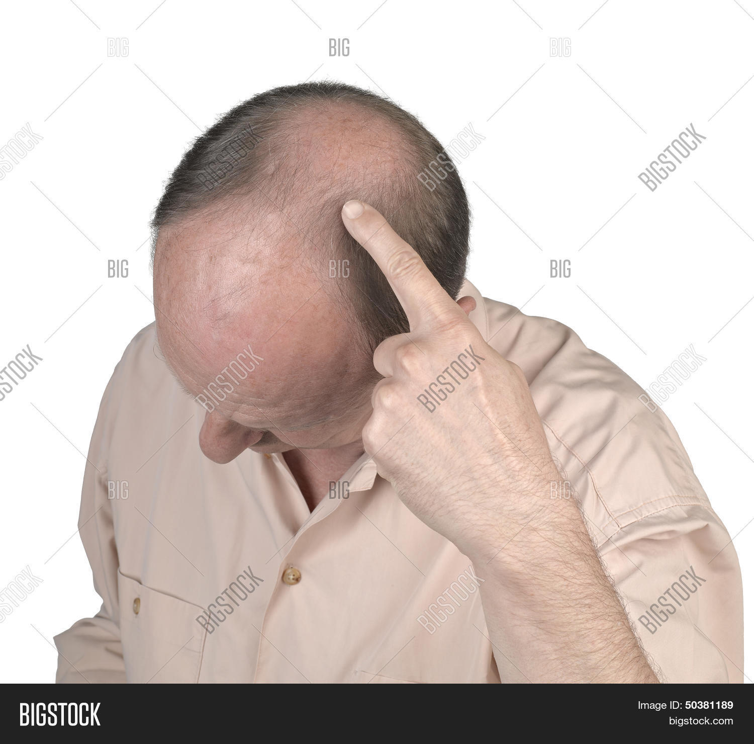 Human Hair Loss - Image & Photo (Free Trial) | Bigstock