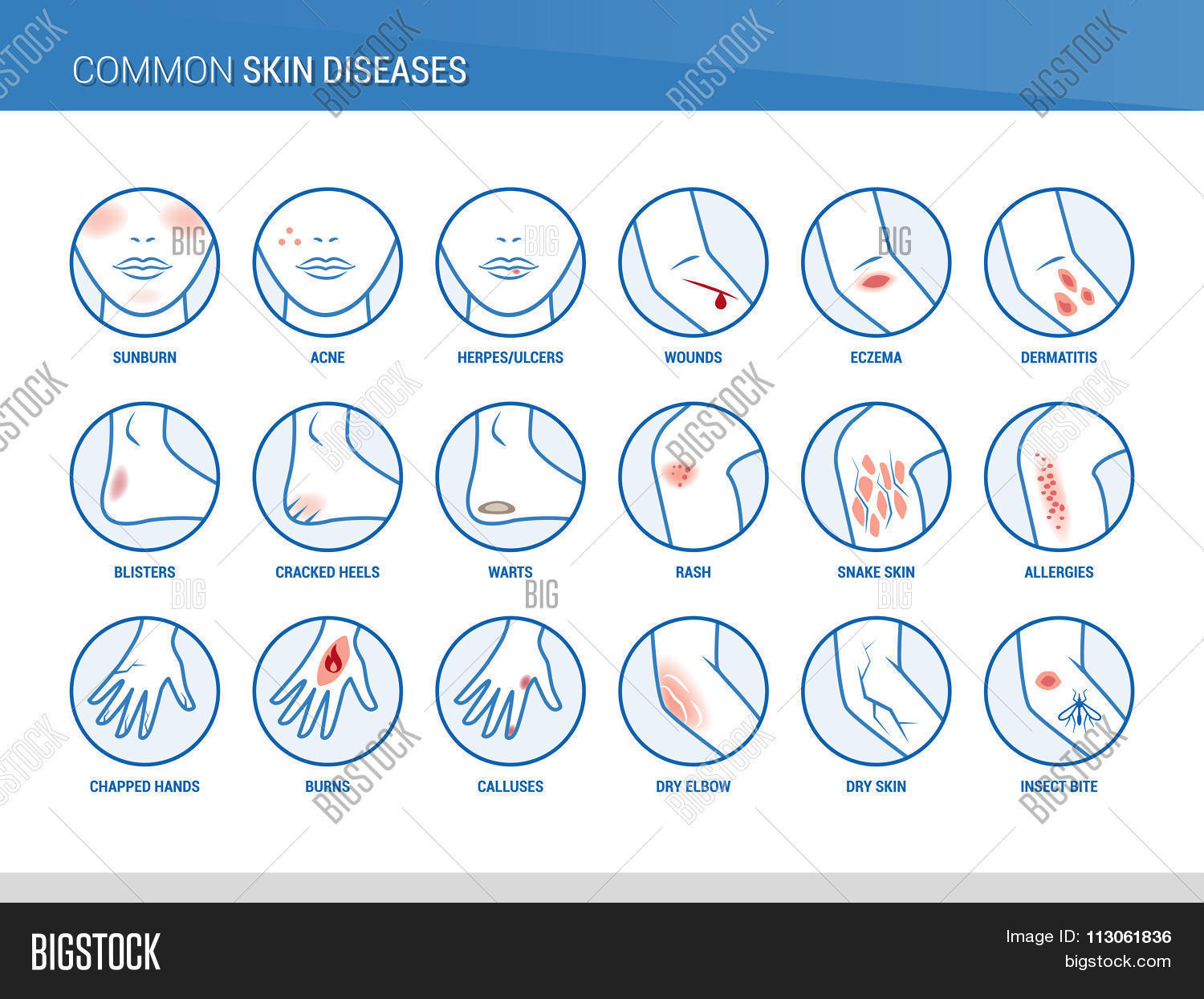 Skin Diseases Vector & Photo (Free Trial) | Bigstock