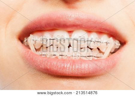 Close- Picture Teeth Image & Photo (Free Trial) | Bigstock