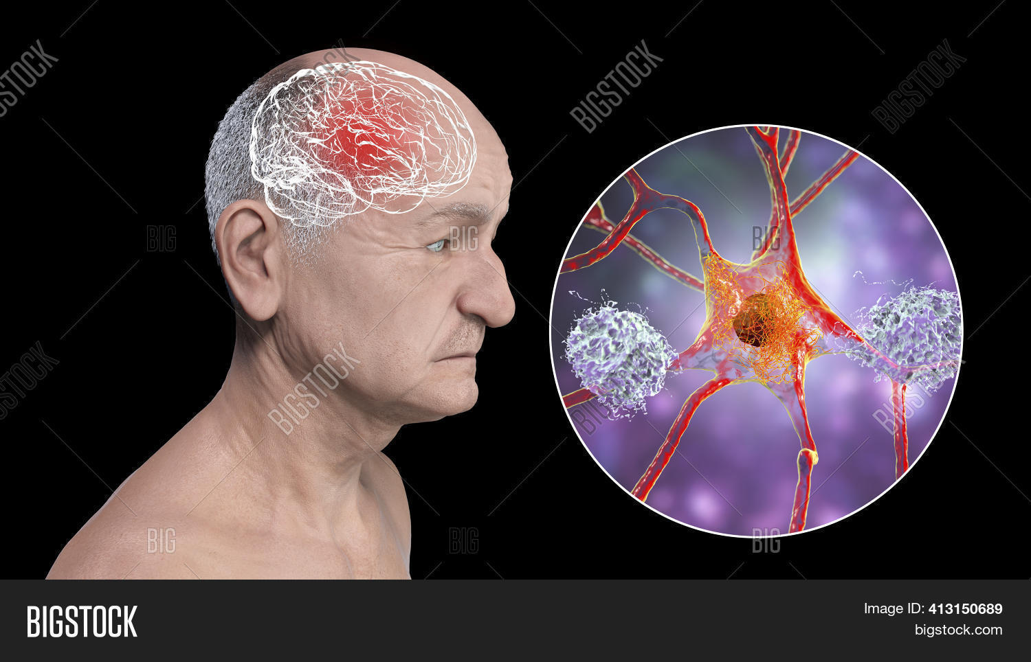 Dementia, Conceptual Image & Photo (Free Trial) | Bigstock