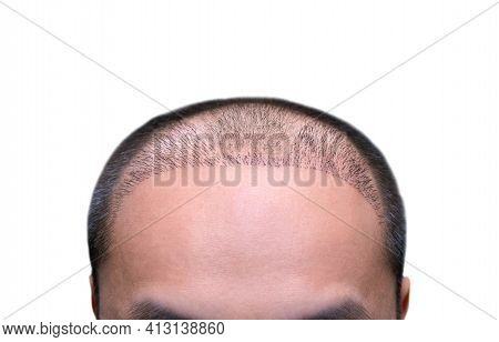 Top View Man's Head Image & Photo (Free Trial) | Bigstock