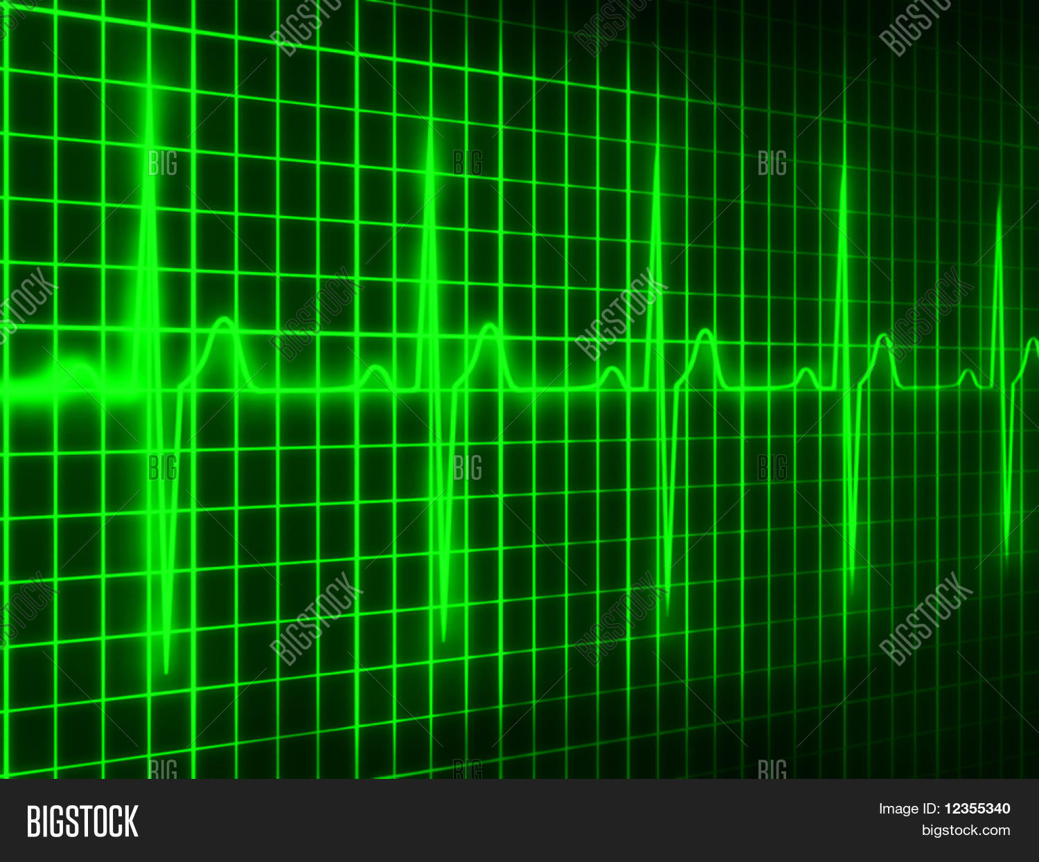 Cardiogram Image & Photo (Free Trial) | Bigstock