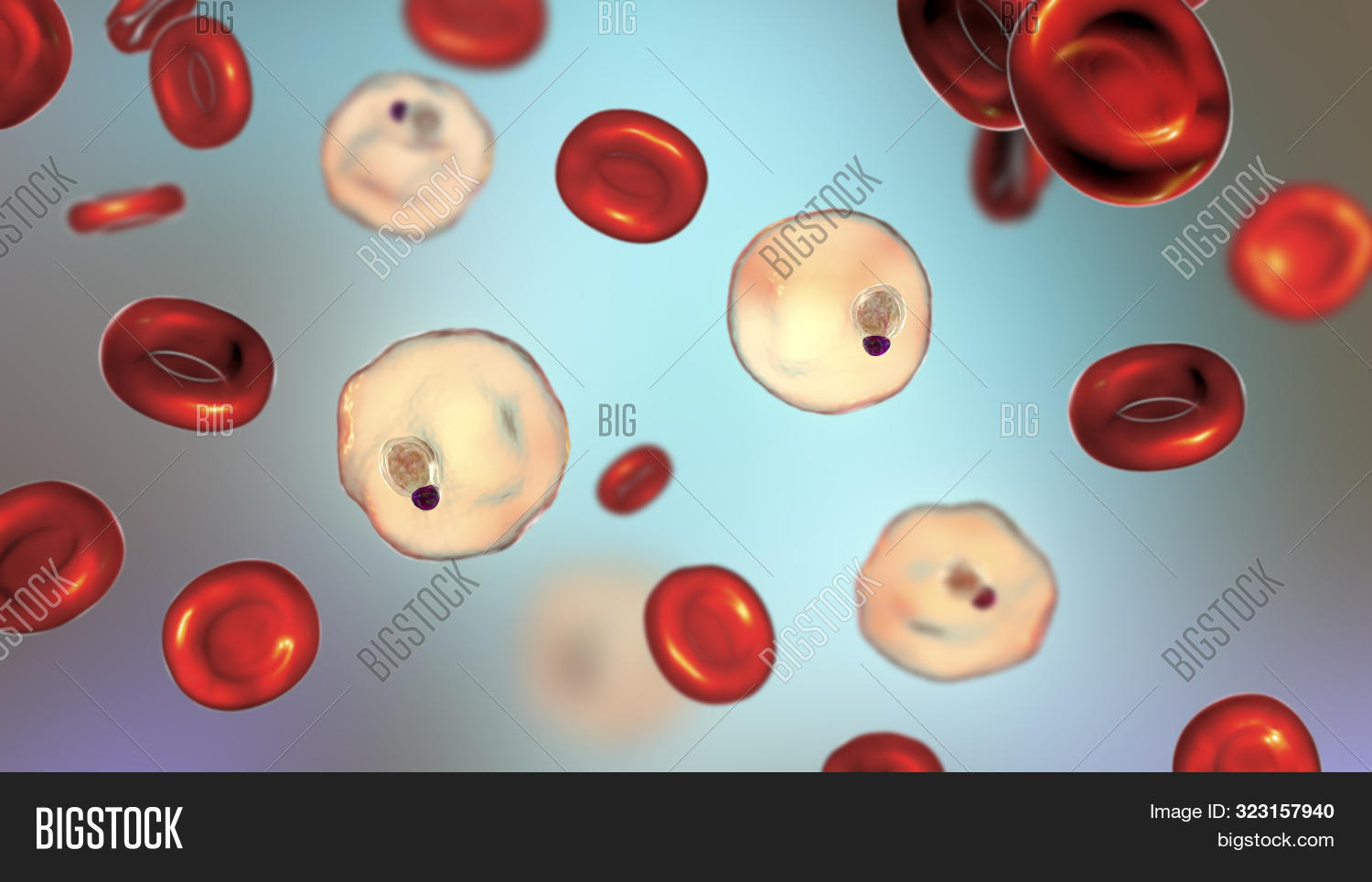Blood Smear Malaria Image & Photo (Free Trial) | Bigstock