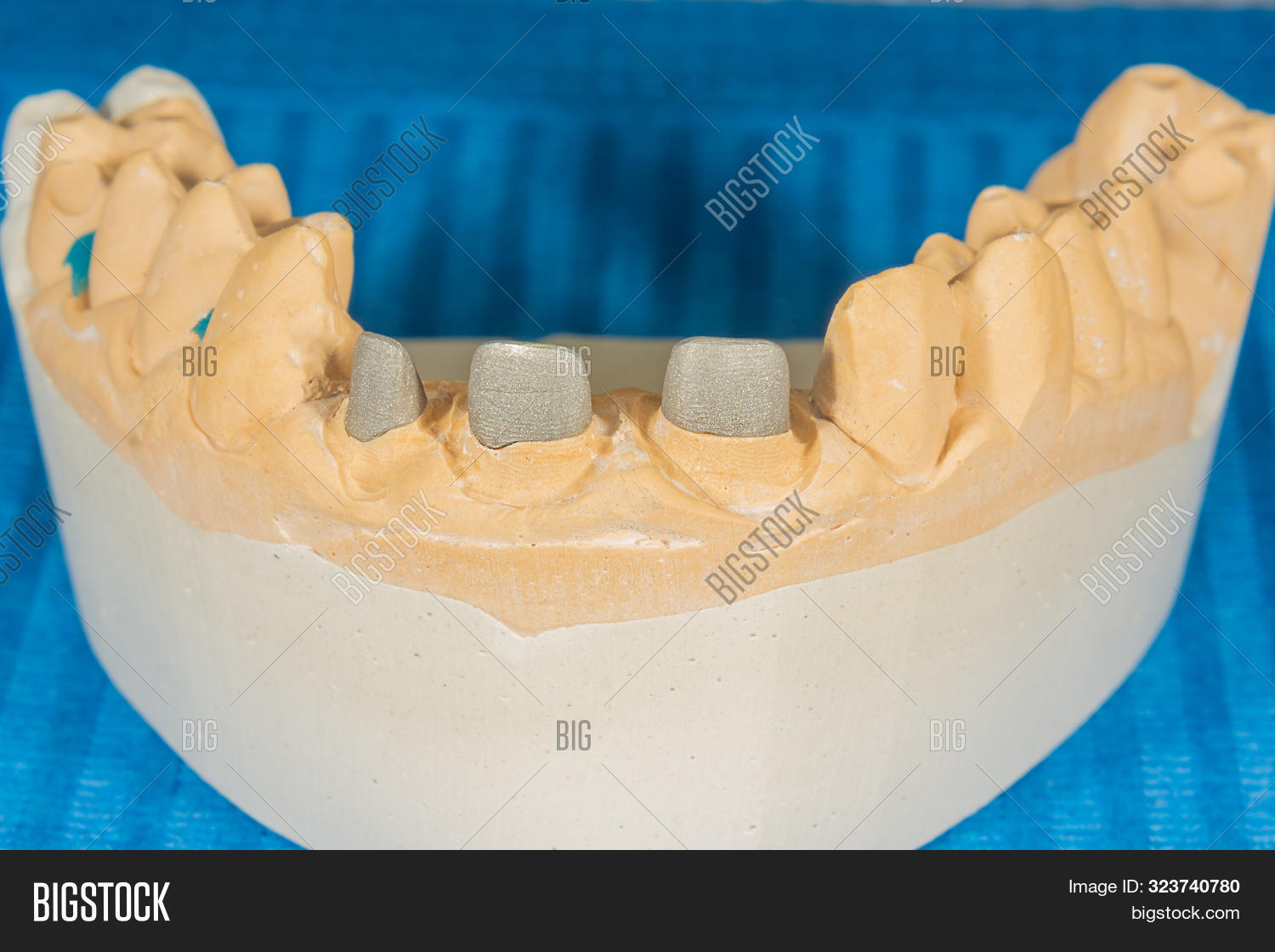 Metal Cast Pin Human Image & Photo (Free Trial) | Bigstock