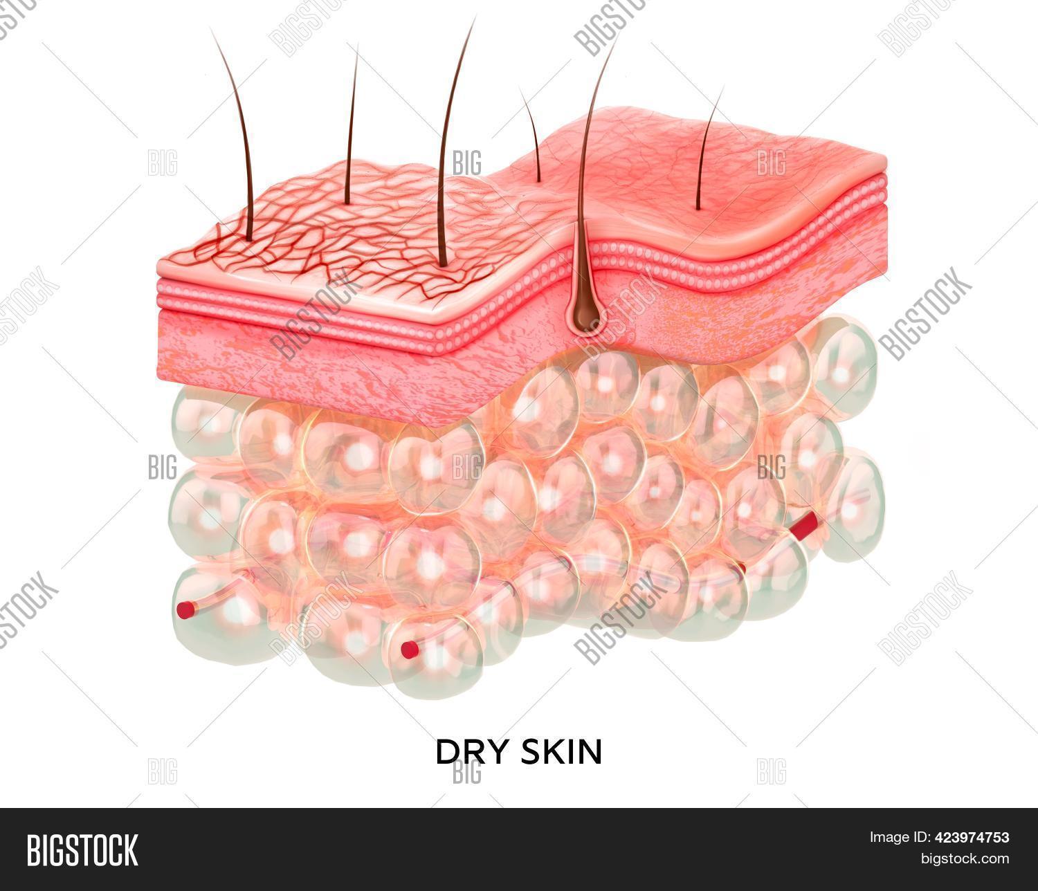 Realistic Human Dry Image & Photo (Free Trial) | Bigstock