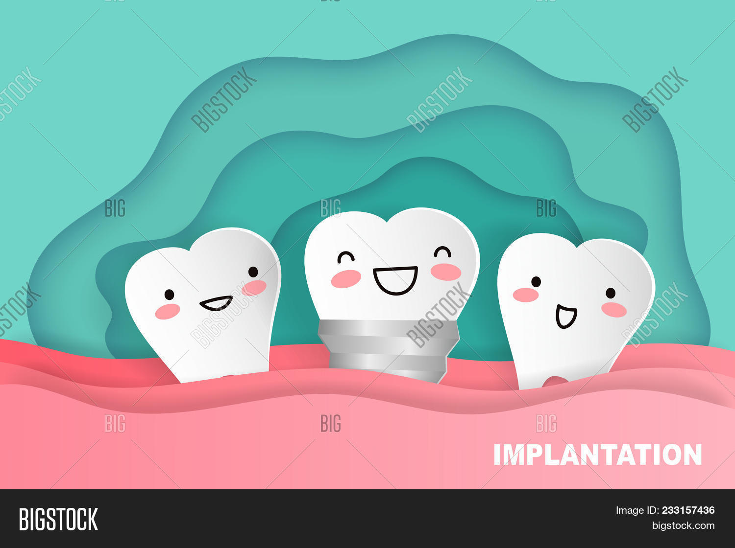 Cartoon Tooth Implant Vector & Photo (Free Trial) | Bigstock