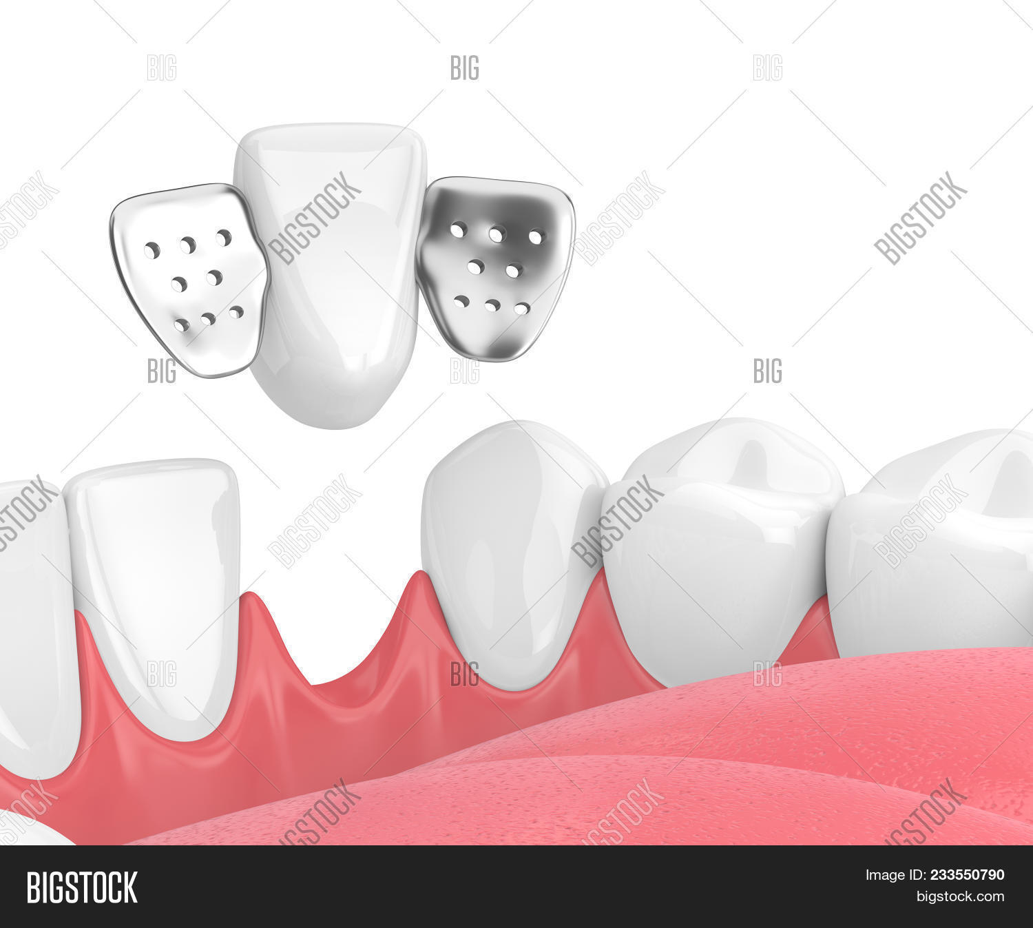 3d Render Jaw Teeth Image & Photo (Free Trial) | Bigstock