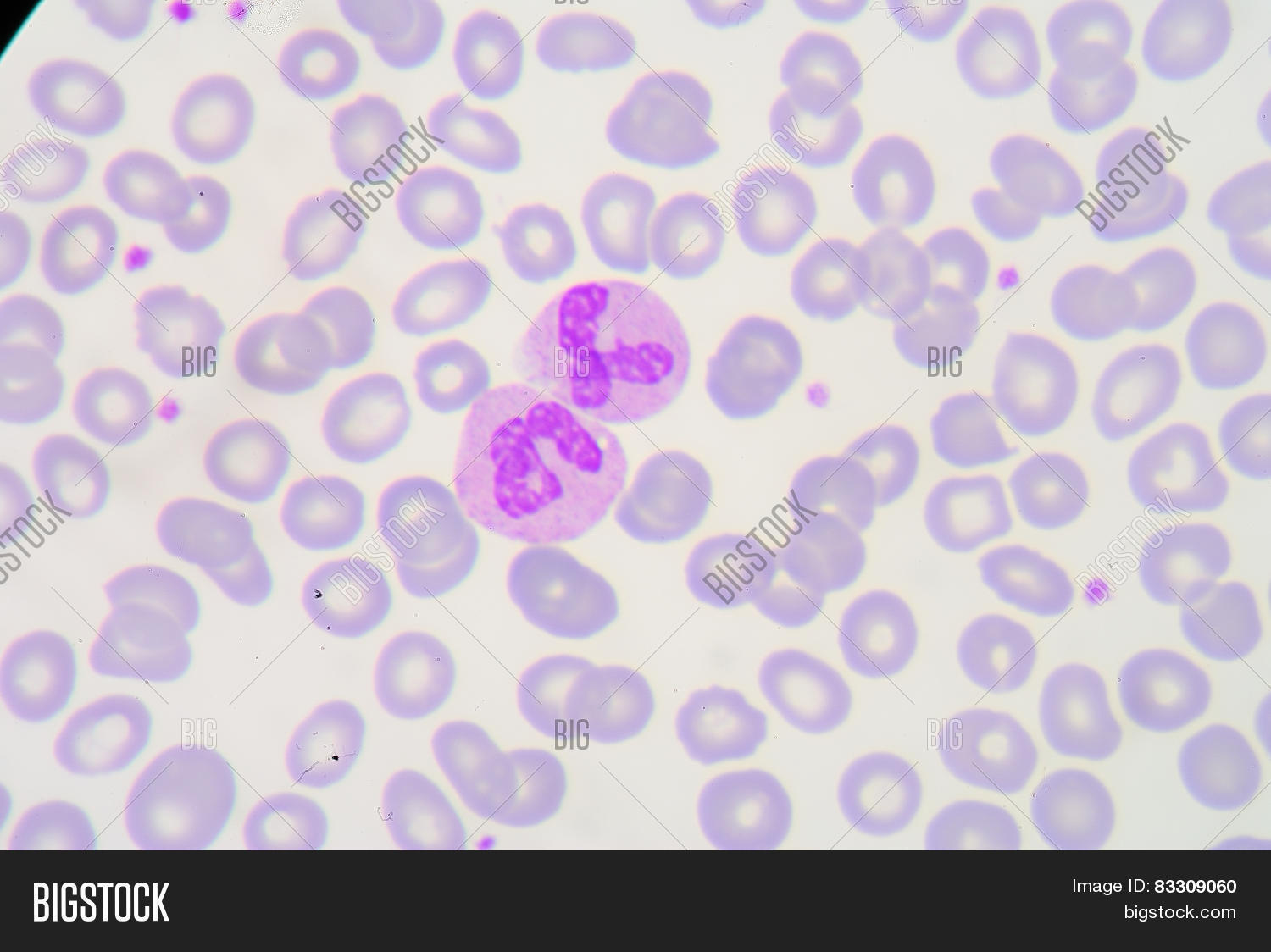 Neutrophils Type Image & Photo (Free Trial) | Bigstock