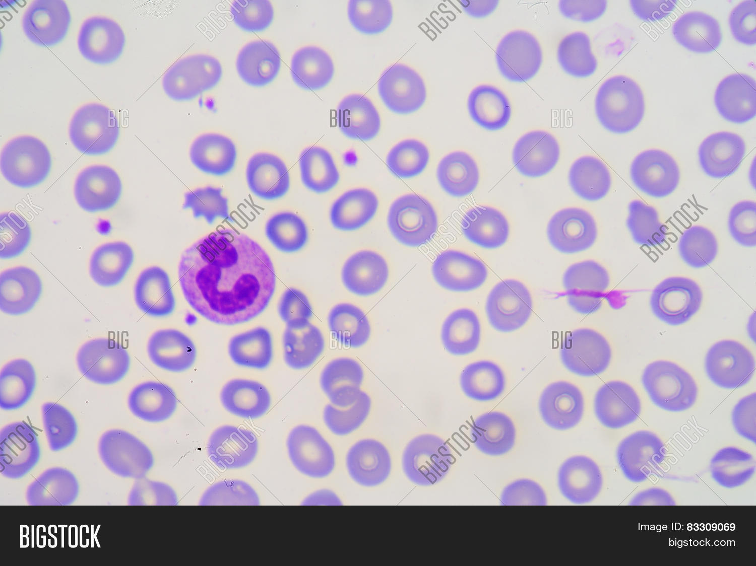 Toxic Granulation Image & Photo (Free Trial) | Bigstock