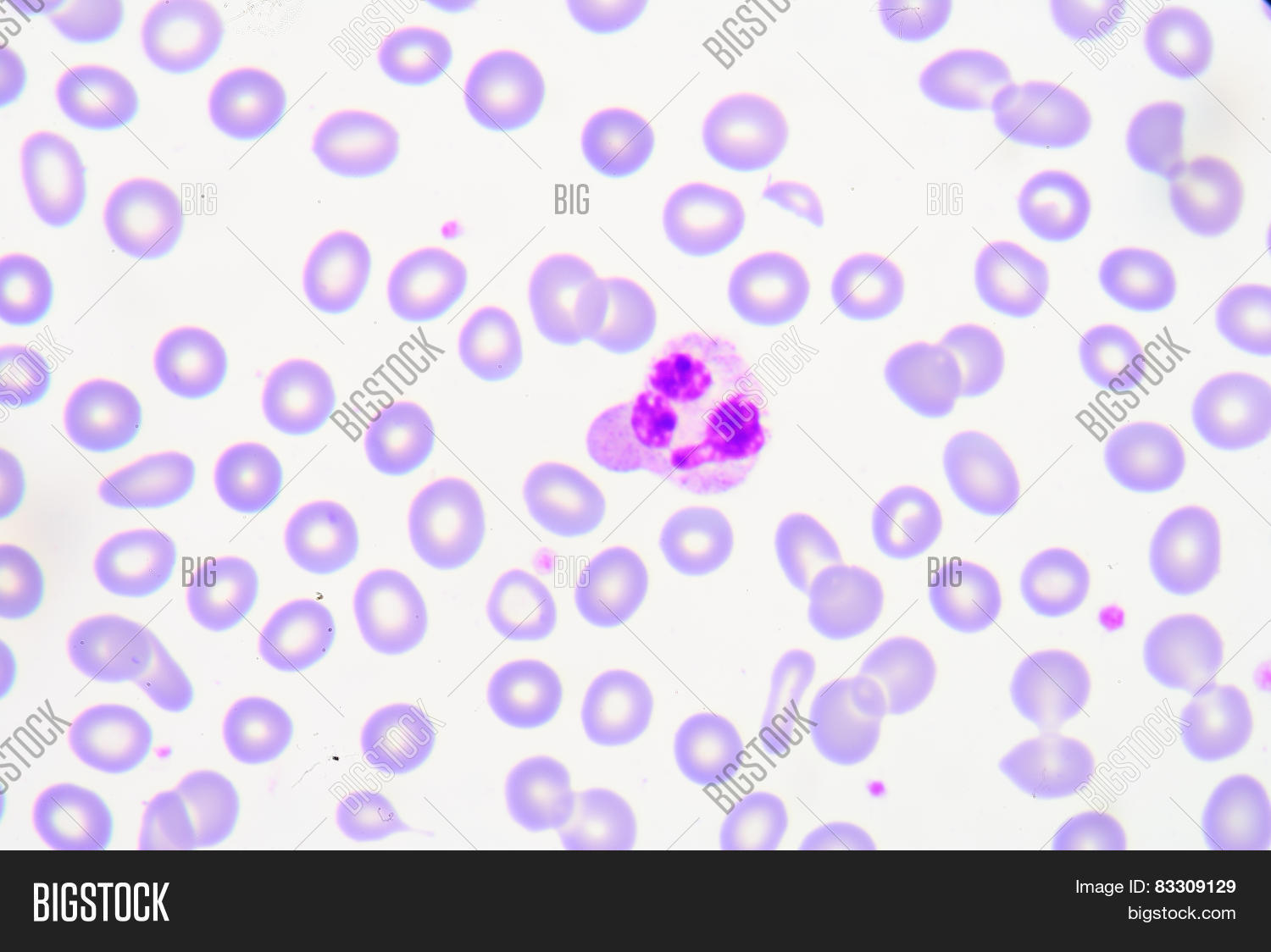 Toxic Granulation Image & Photo (Free Trial) | Bigstock