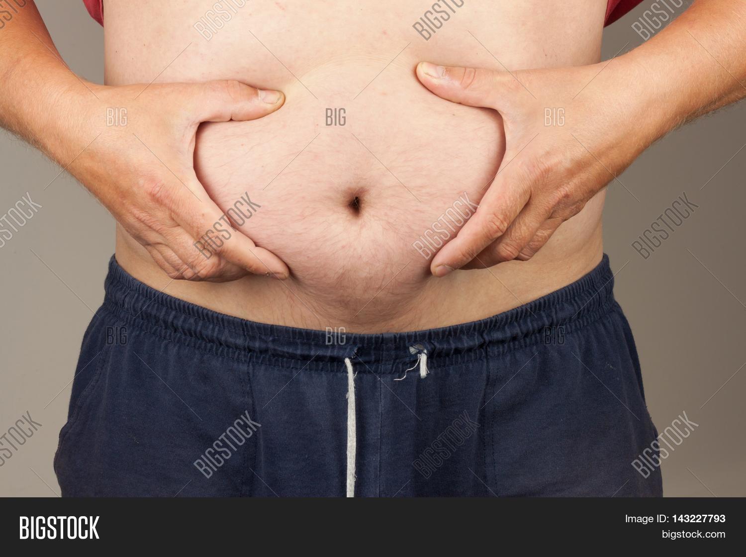 Obese Fat Man. Man Image & Photo (Free Trial) | Bigstock