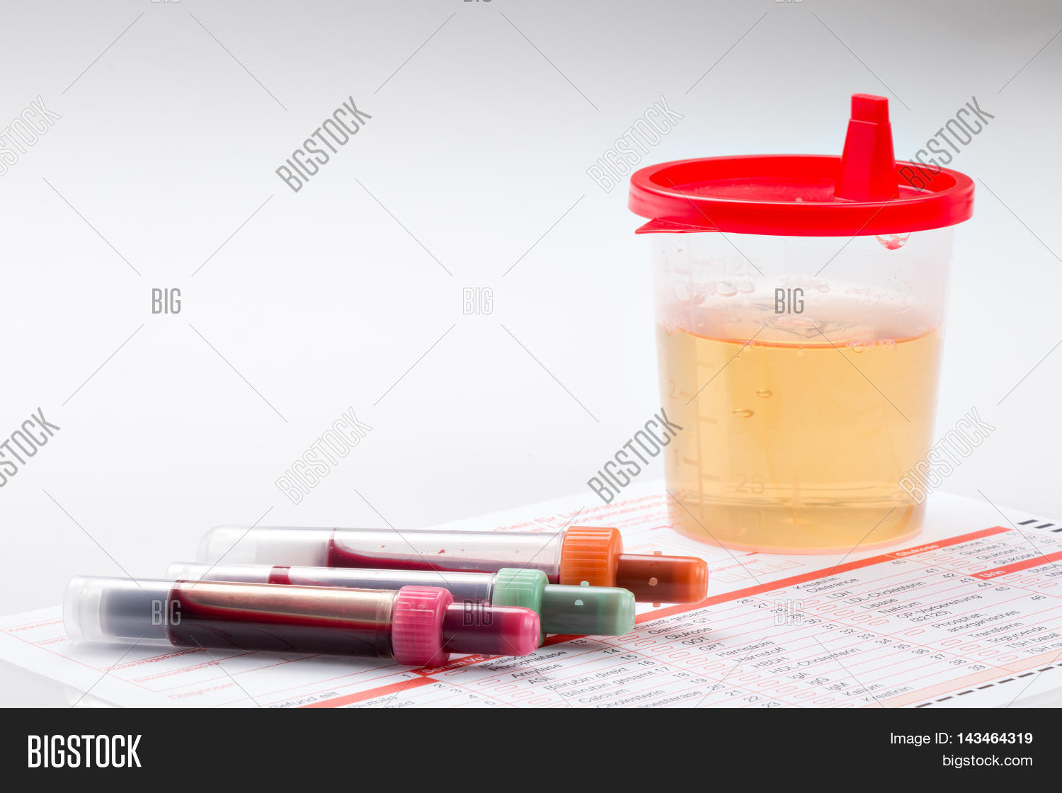 Urine Blood Test ( Image & Photo (Free Trial) | Bigstock