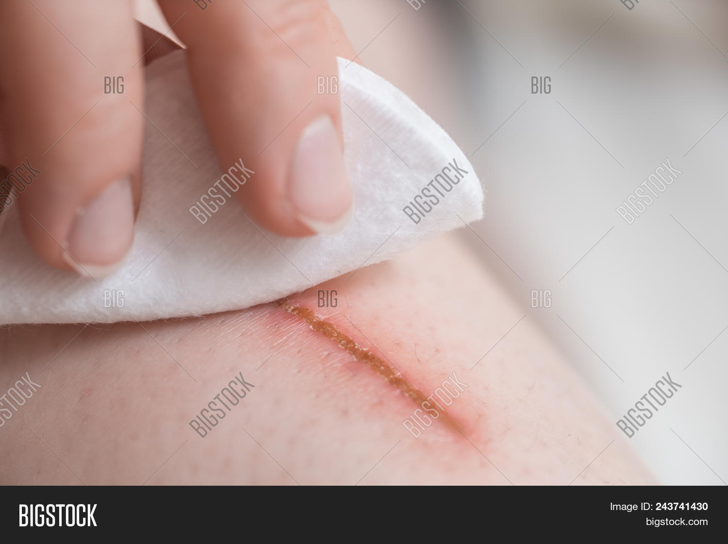 Nurse Cleaning Wound Image & Photo (Free Trial) | Bigstock
