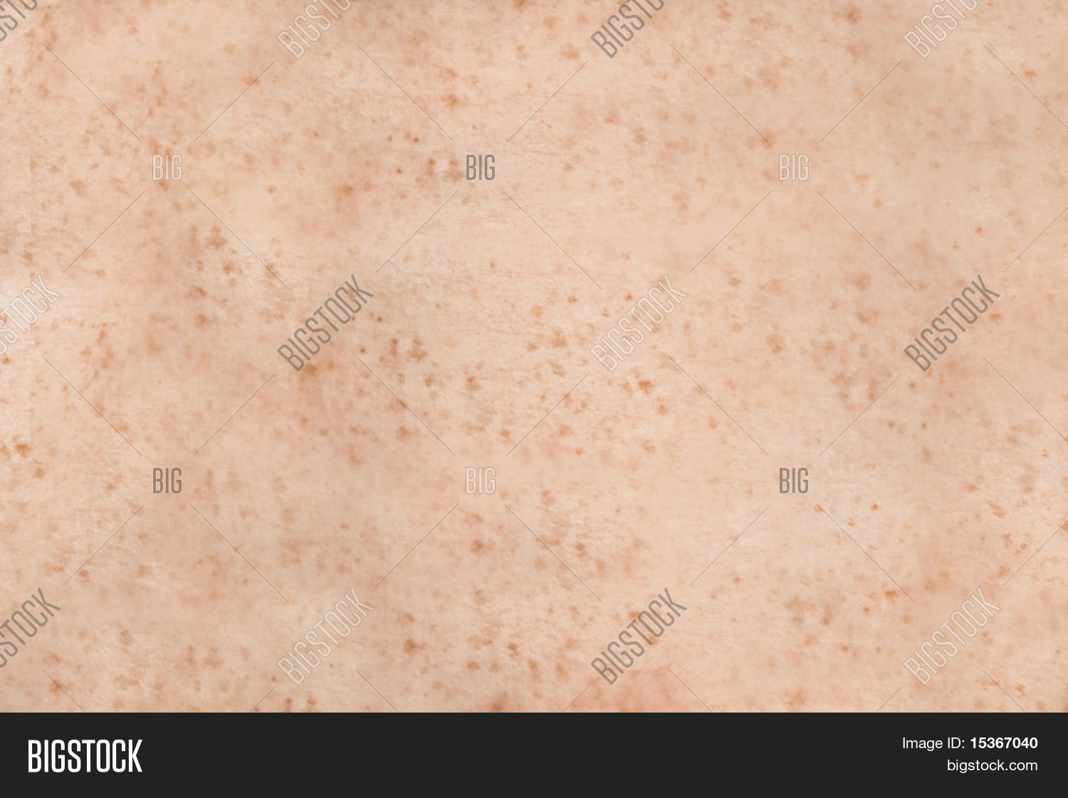 Freckled Human Skin. Image & Photo (Free Trial) | Bigstock