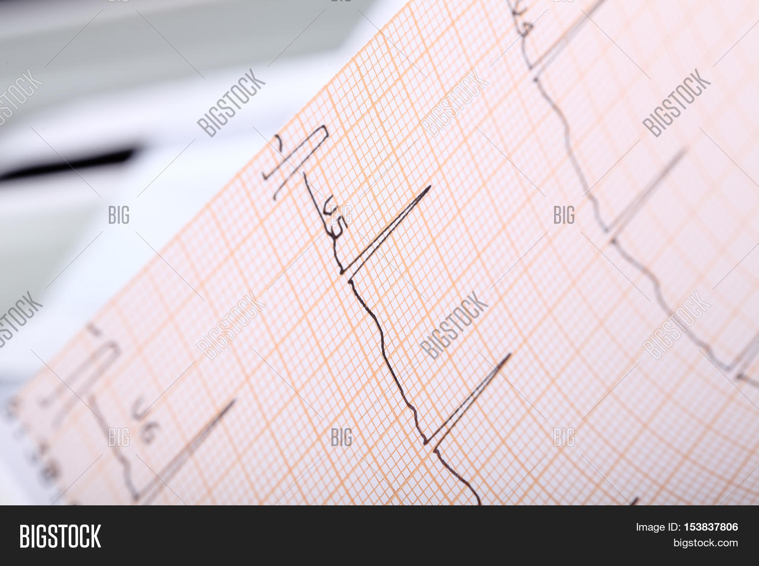 ECG Complex On Paper. Image & Photo (Free Trial) | Bigstock