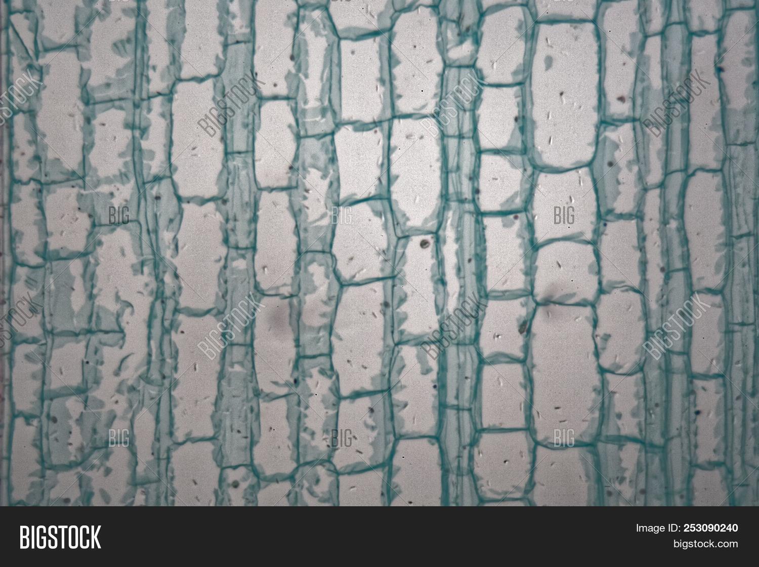 Longitudinal Section Image & Photo (Free Trial) | Bigstock