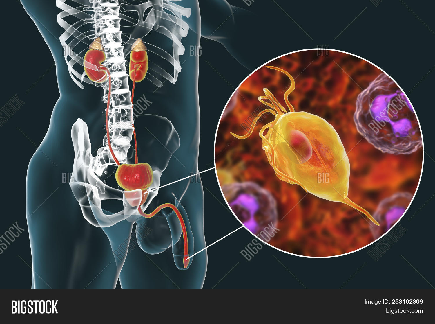 Trichomoniasis Image & Photo (Free Trial) | Bigstock