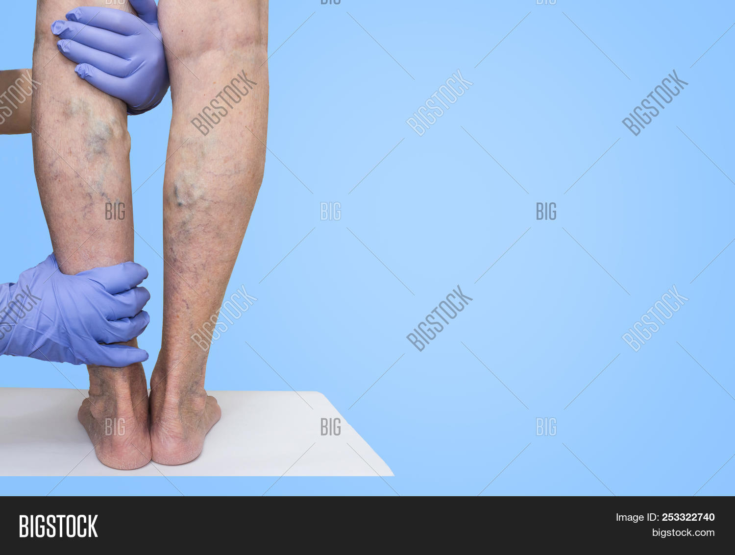 Lower Limb Vascular Image & Photo (Free Trial) | Bigstock