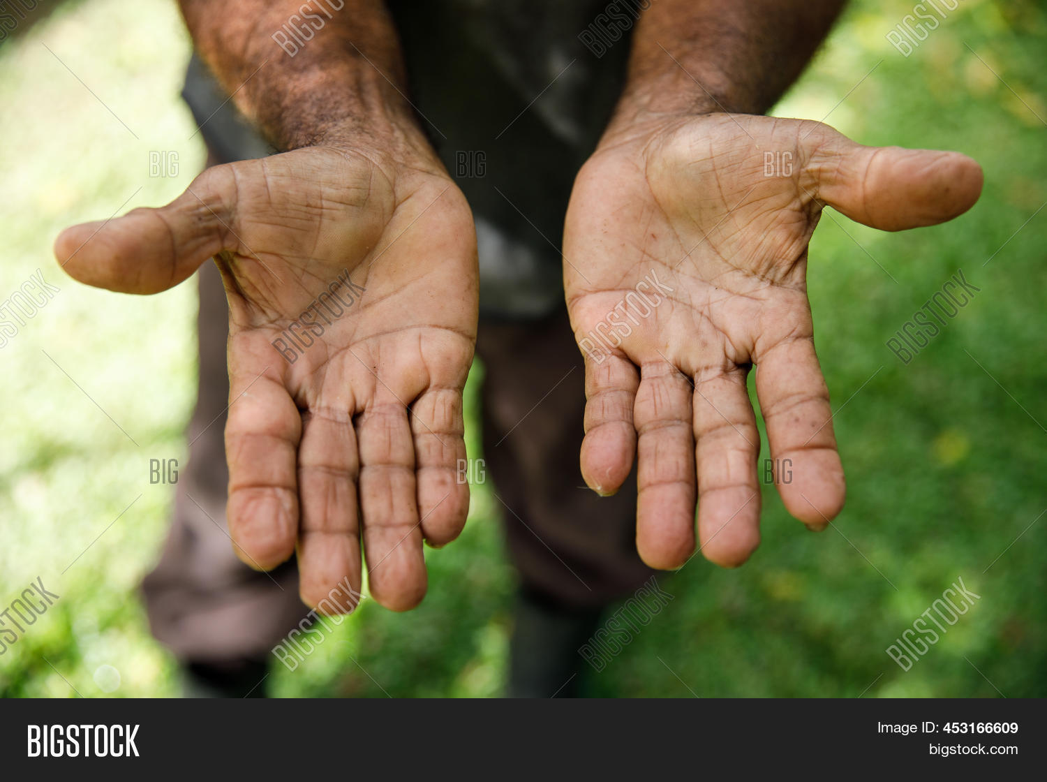 Overworked Hands Image & Photo (Free Trial) | Bigstock