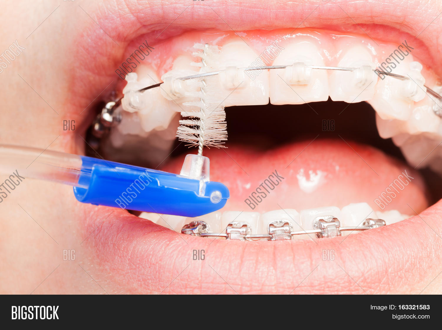 Using Interdental Image & Photo (Free Trial) | Bigstock