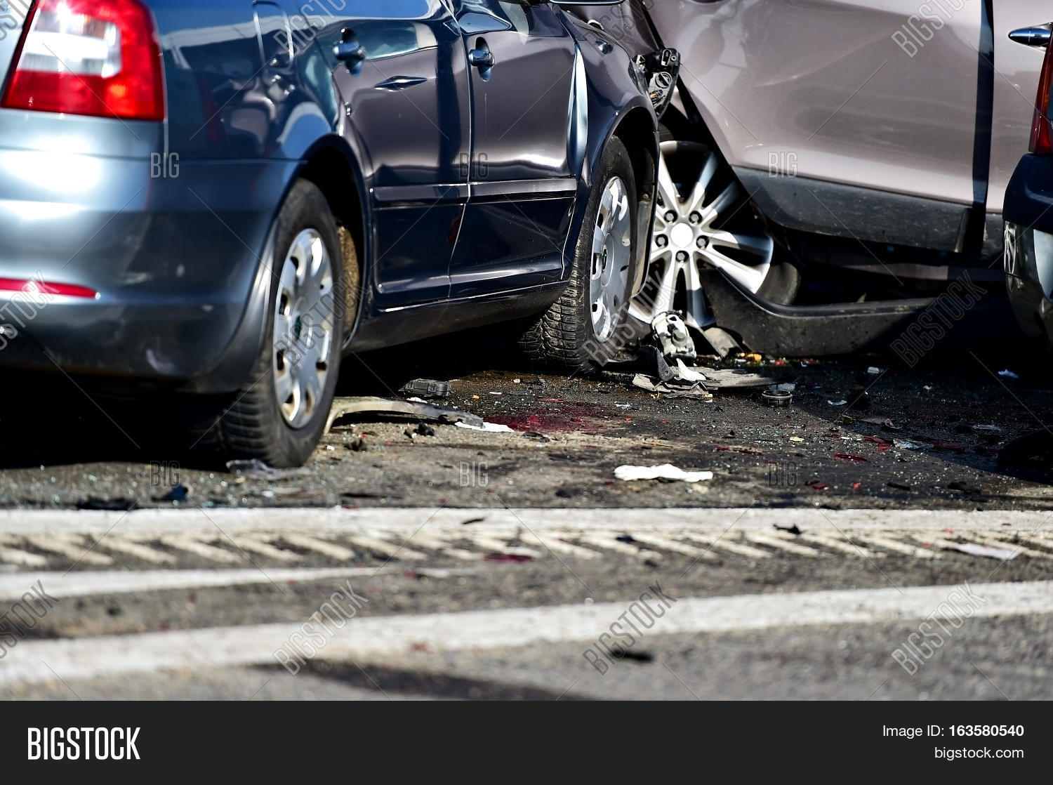 Detail Damage Image & Photo (Free Trial) | Bigstock